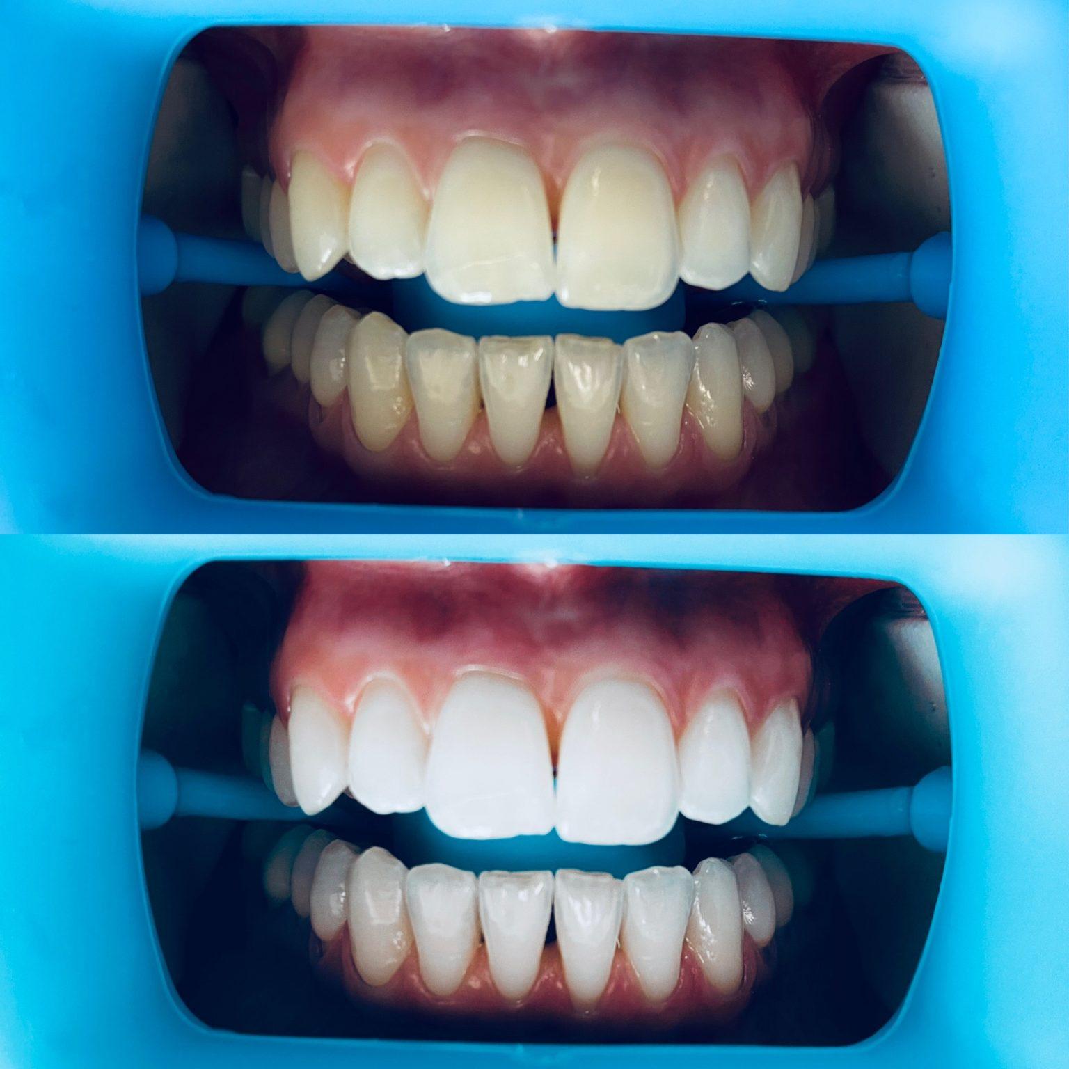 Zahnästhetik | Kirchberg Klinik - Zahnarzt Andernach